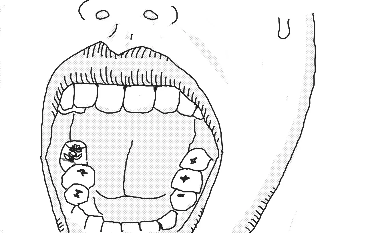 インプラントとイプラント - moshik.kr